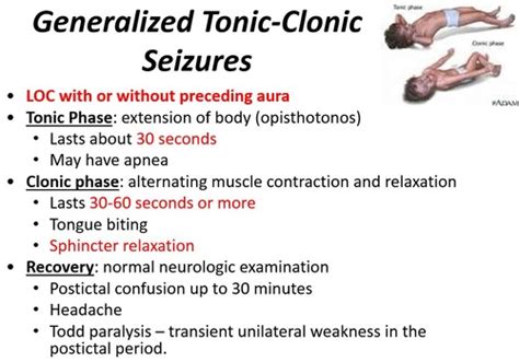Tonic Clonic Seizure
