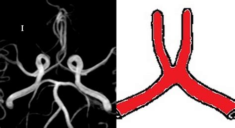 Dr Balaji Anvekar FRCR Absent Acom