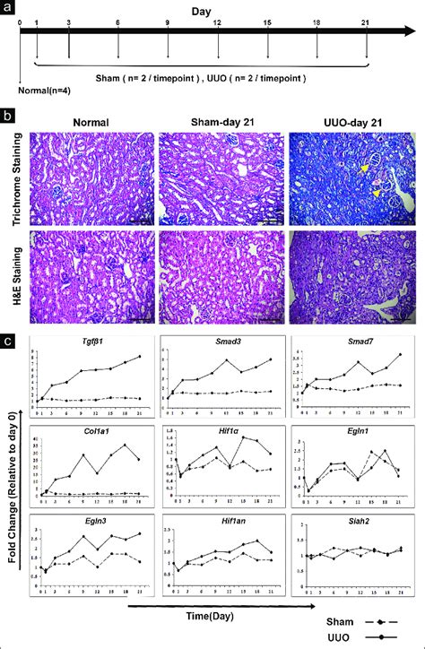 The Expression Level Of Tgf β And Hypoxia Pathway Related Genes In