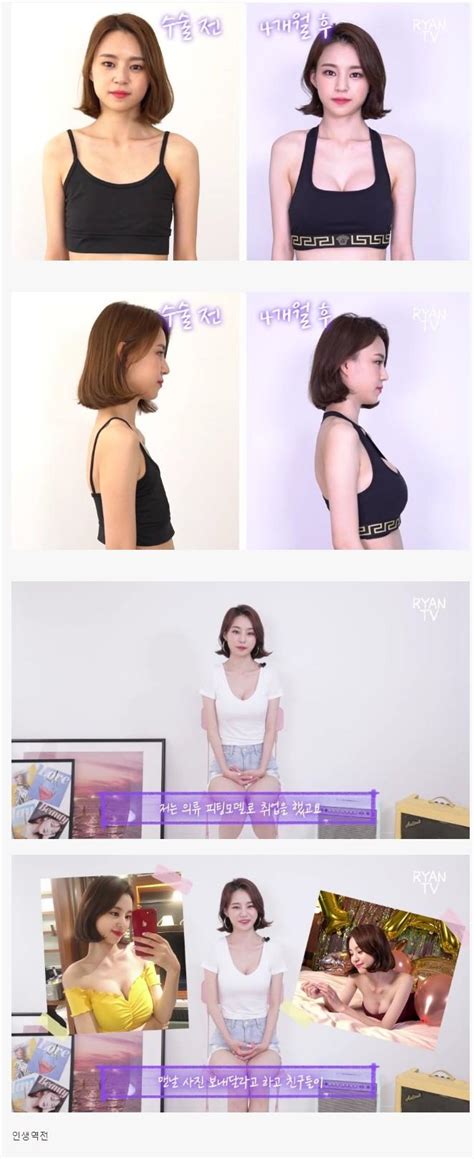 가슴수술 순기능 ㄷㄷㄷㄷㄷ 포텐 터짐 최신순 에펨코리아