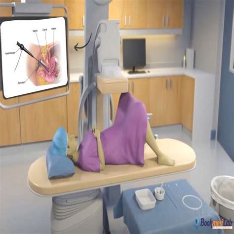 X Ray Hysterosalpingography Hsg Test Price In Delhi India Ganesh