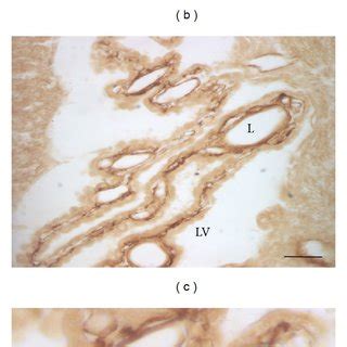 Coronal Sections Of Rats Showing Choroid Plexus Of The Lateral Download Scientific Diagram