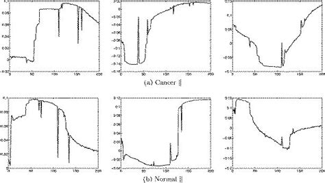 Characterizing Breast Cancer Tissues Through The Spectral Correlation Properties Of Polarized