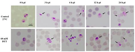 Babesia Bigemina