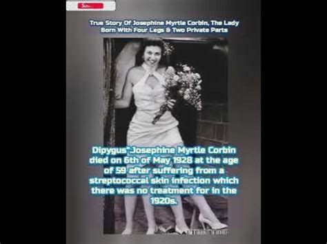 True Story Of Josephine Myrtle Corbin The Lady Born With Four Legs