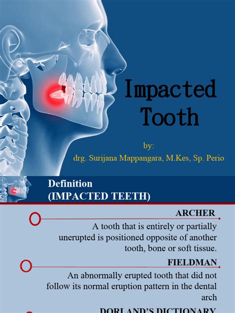 Edit 3 Gigi Impaksi Klasifikasi And Penatalaksanaannya 2018 Autosaved