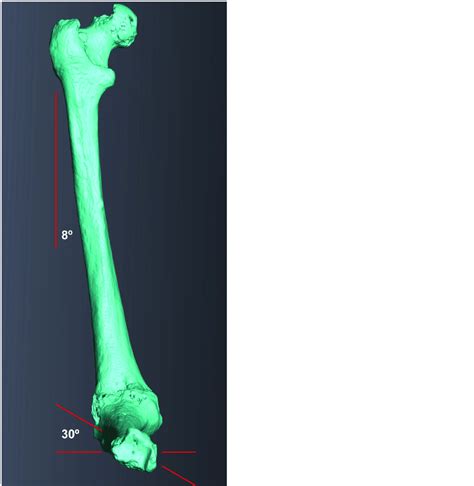 Figure S6 The Left Leg Of Individual 1 Showing The Rotation Of The