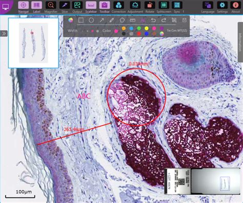 Hiview Ai Powered Pathology