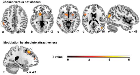 Results From The Traditional Mass Univariate Fmri Analysis Ae Brain