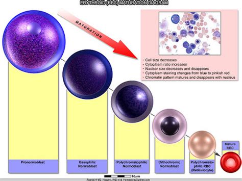 Basophilia Of Chromatin Full Article Acute Basophilic Leukemia Basophilia Of Chromatin Full Article Acute Basophilic Leukemia