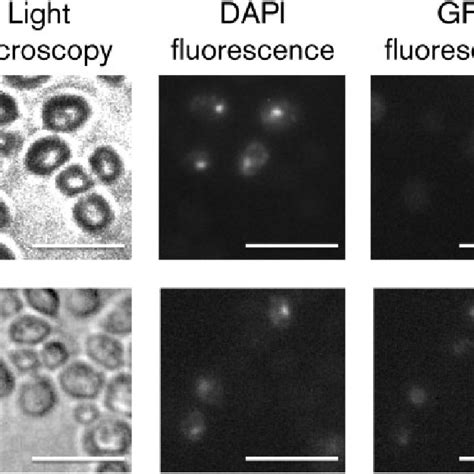 Fluorescence Microscopy Localization Of Gfp And The Sexm Gfp Fusion