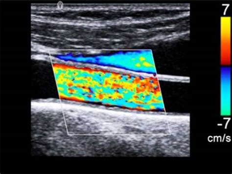 Ardms Spi Dumps V8 02 Sonography Principles And Instrumentation Ardms Spi Exam Preparation