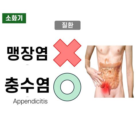 충수염 Appendicitis 의학당