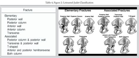 Classification Of Pelvis And Aetabulum Injuries Trauma International Classification Of Pelvis And Aetabulum Injuries Trauma International