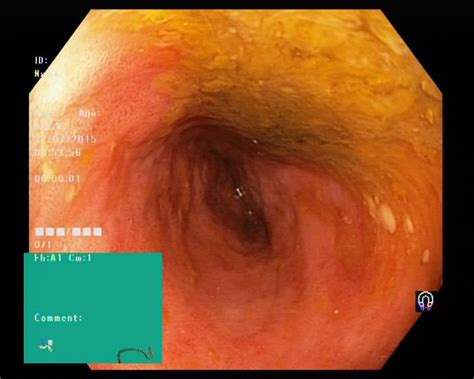 Simulametkvasir Vqa X1 · Datasets At Hugging Face