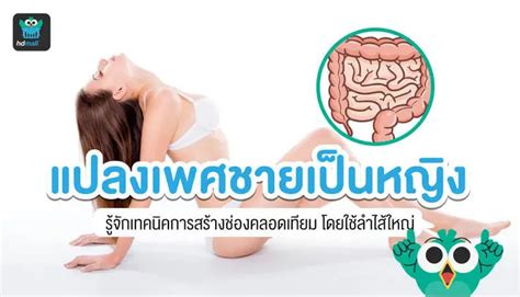 ผ่าตัดแปลงเพศชายเป็นหญิง คืออะไร มีกี่วิธี ต้องทำอย่างไร