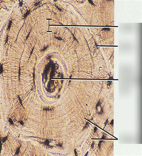 Microanatomy Of Bone Diagram Quizlet