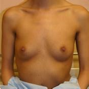 What Is The Volume In Cc Of A Cup Size