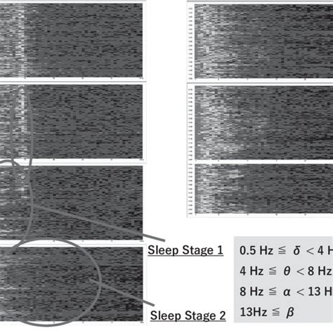 Sleep Eeg Distribution Map Actually Measured Download Scientific Diagram