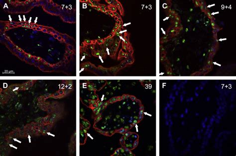 Detection Of Active Rnap Ii Ae Immunofluorescence For Rnap Ii