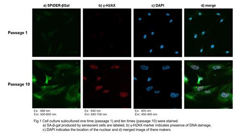 Senescence Cell Detection Cellular Senescence Detection Kit Spider β