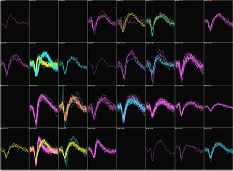 Spike Wave All About Neural Activity