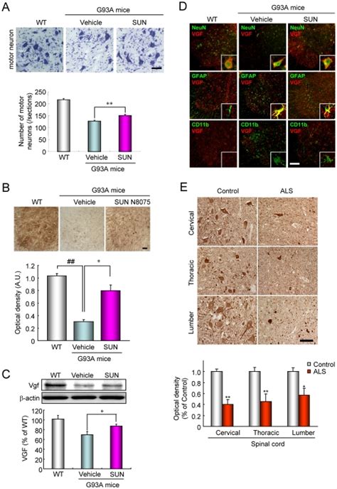 A Cresyl Violet Staining B Vgf Immunostaining C Vgf Download Scientific Diagram