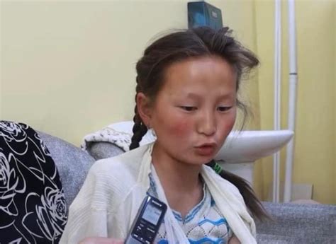 13 настай охин хонины захад чононд бариулсан ч амьд гарч чаджээ Ontsgoi Mn