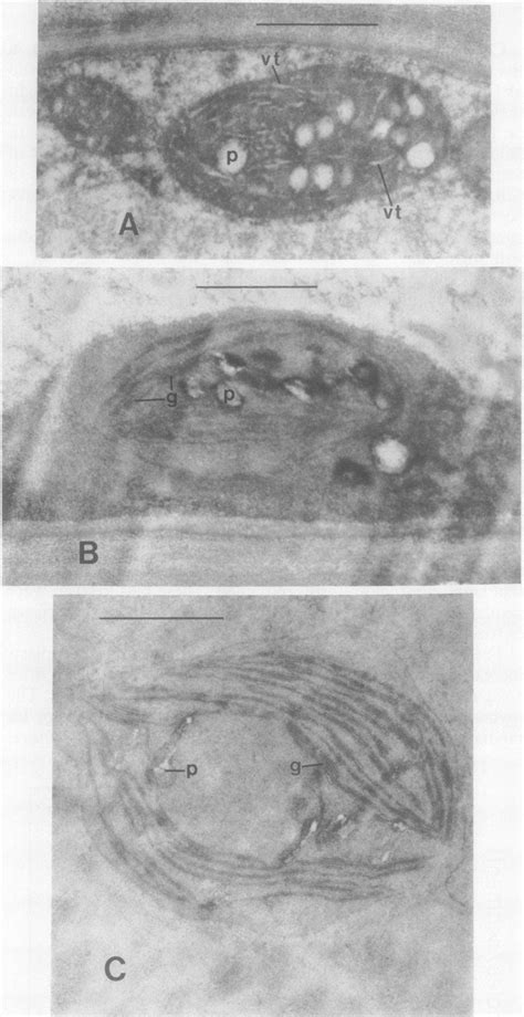 Electron Micrographs Of Plastids At Different Stages Of Rever