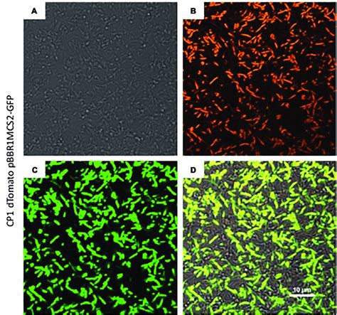 Fluorescence Imaging Of Expression Of Green Fluorescent Protein Gfp