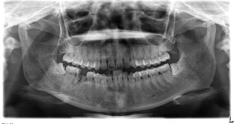 Thesis Project Object Detection Dataset By Skripsiselesai