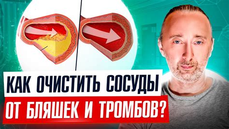 Только ТАК можно очистить СОСУДЫ от: холестерина, бляшек и тромбов! Вот ...
