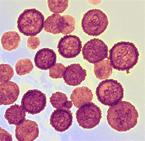 Sin Nombre Virus Particles Tem By Science Photo Library