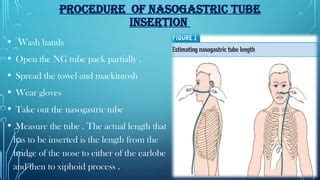 Nasogastric Tube Insertion And Nasogastric Tube Feeding Pptx