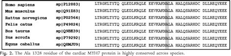 Figure 2 From A Novel Mutation Of The Myh 7 Gene In A Patient With