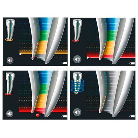 Raypex 6 Apexlokátor Apexdental