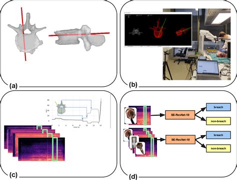 Automatic Breach Detection During Spine Pedicle Drilling Based On