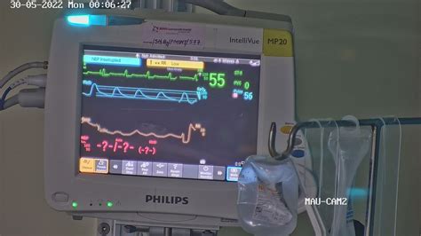 Ecg Detection Roboflow Universe