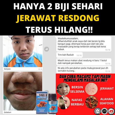 Jerawat Resdung Muka Ko Dengan Jalan Tar Takda Beza
