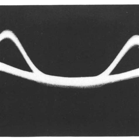 Radiation Pulse Superimposed On A 75 Mhz Sinusoidal Sweep Download