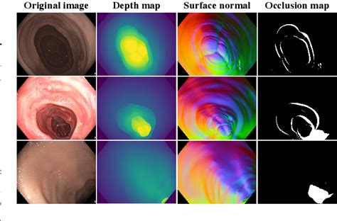 Figure 1 From Multi Task Learning With Cross Task Consistency For Improved Depth Estimation In