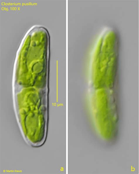 Closterium Pusillum Real Micro Life