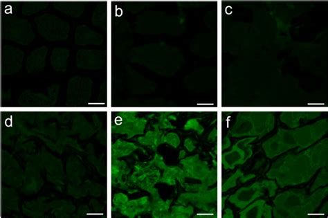Green Autofluorescence Signal Of Differently Processed Soybean Soybean Download Scientific