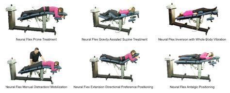 spinal decompression therapy faq spinal decompression missouri