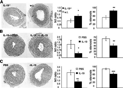 Il 19 Regulates Neointimal Hyperplasia A Il 19 À À Mice Demonstrate