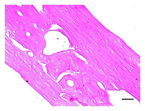 Decellularized Rat Calvaria Hematoxylin And Eosin Stained Download Scientific Diagram
