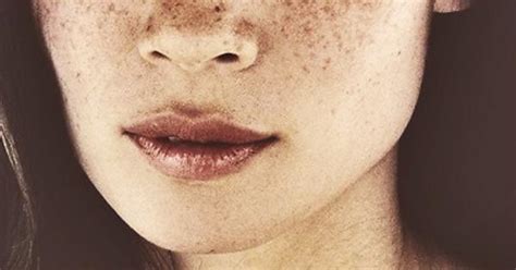Those Freckles Imgur