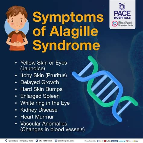 Alagille Syndrome Symptoms Causes And Treatment Options