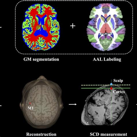 illustration of three‐dimensional scalp‐to‐cortex distance scd