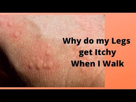Why Do My Legs Itch So Bad After Shaving - AthleticFly